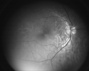 epiCam M – 杏國新藥股份有限公司